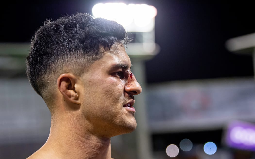 Dylan Brown pleads guilty to groping woman | RNZ News