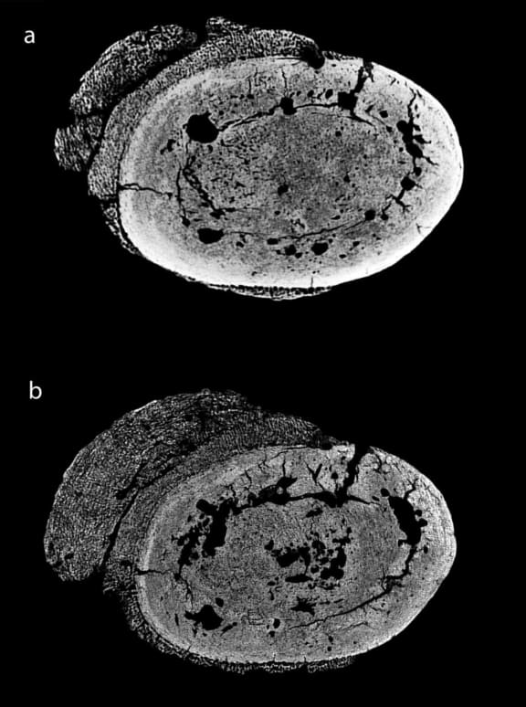 Dinosaurs got cancer too | A Gallery from Afternoons | RNZ National