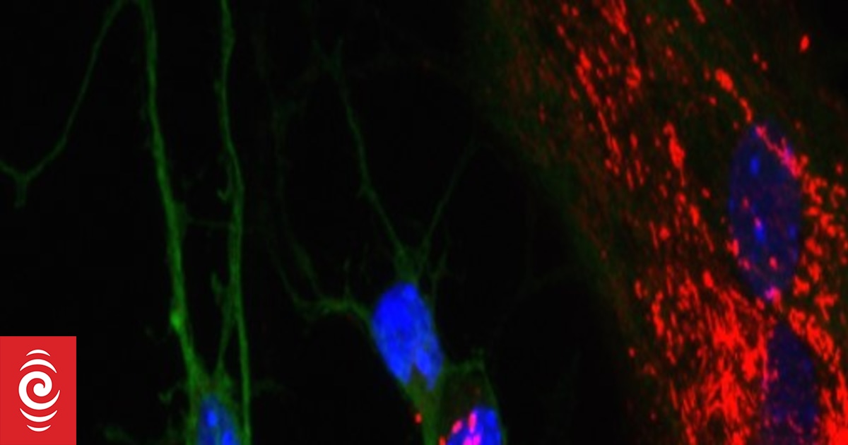 Prof Mike Berridge: recognising vital work in cellular science | RNZ