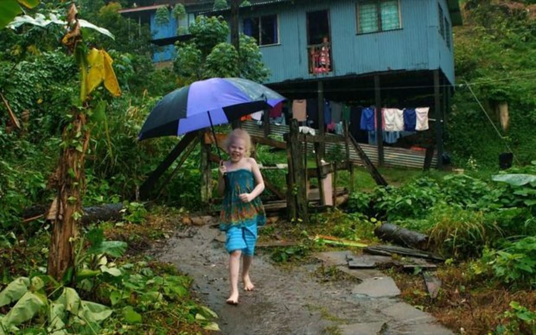 Fiji urged to help people with albinism "out of the shadows" | RNZ News