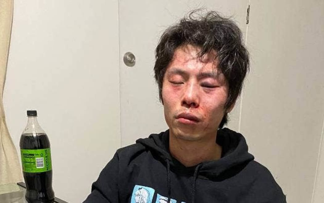 Tenant believes he should get his bond back, landlord claims he didn’t ...