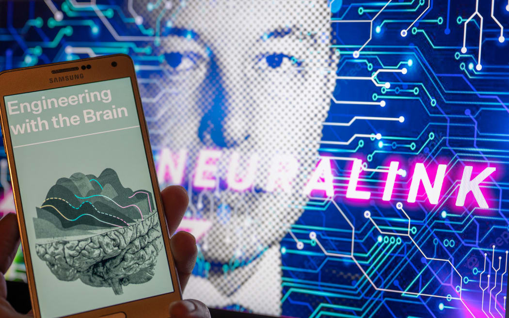 Elon Musk's Neuralink says it has approval to put brain-chips in humans ... Elon Musk's Neuralink says it has approval to put brain-chips in humans ...