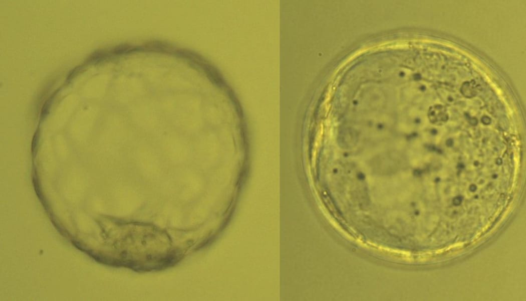 A new test for IVF embryos | RNZ