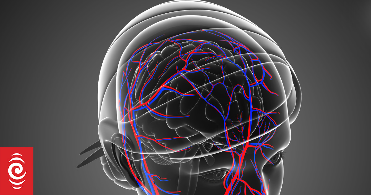 A good blood supply is good for memory | RNZ